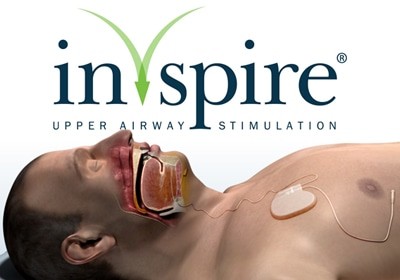 Inspire Medical Systems (INSP) Acceleration Program Case